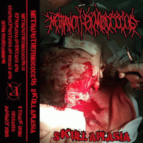 Methanthermococcus Skull Aplasia (Demo)- Spirit of Metal Webzine (en)
